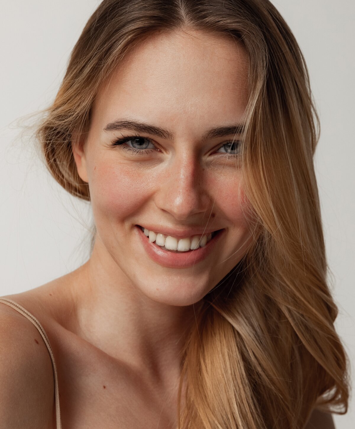 Dysport San Antonio, TX | Dr. Garza Plastic Surgery